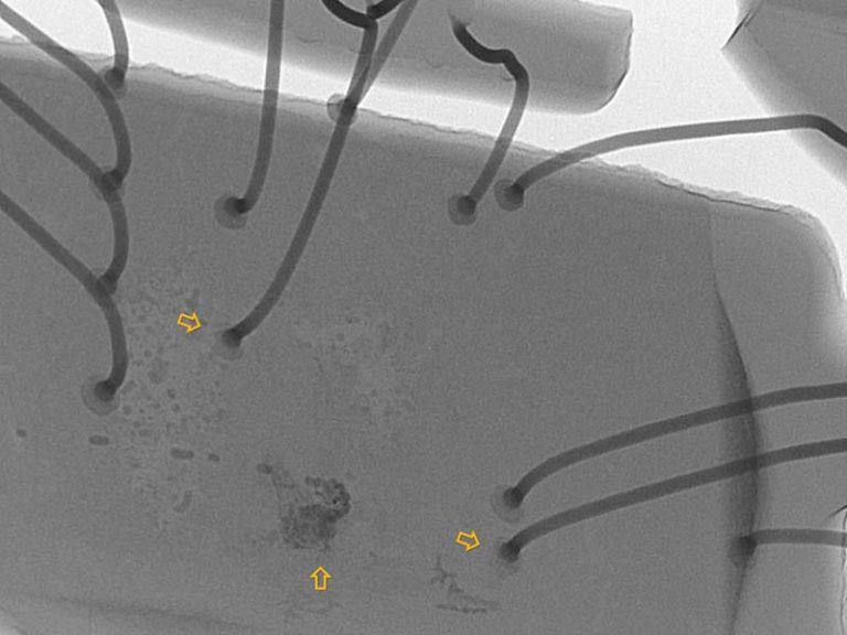 X-ray Inspection (2D X-ray) - iST-Integrated Service Technology